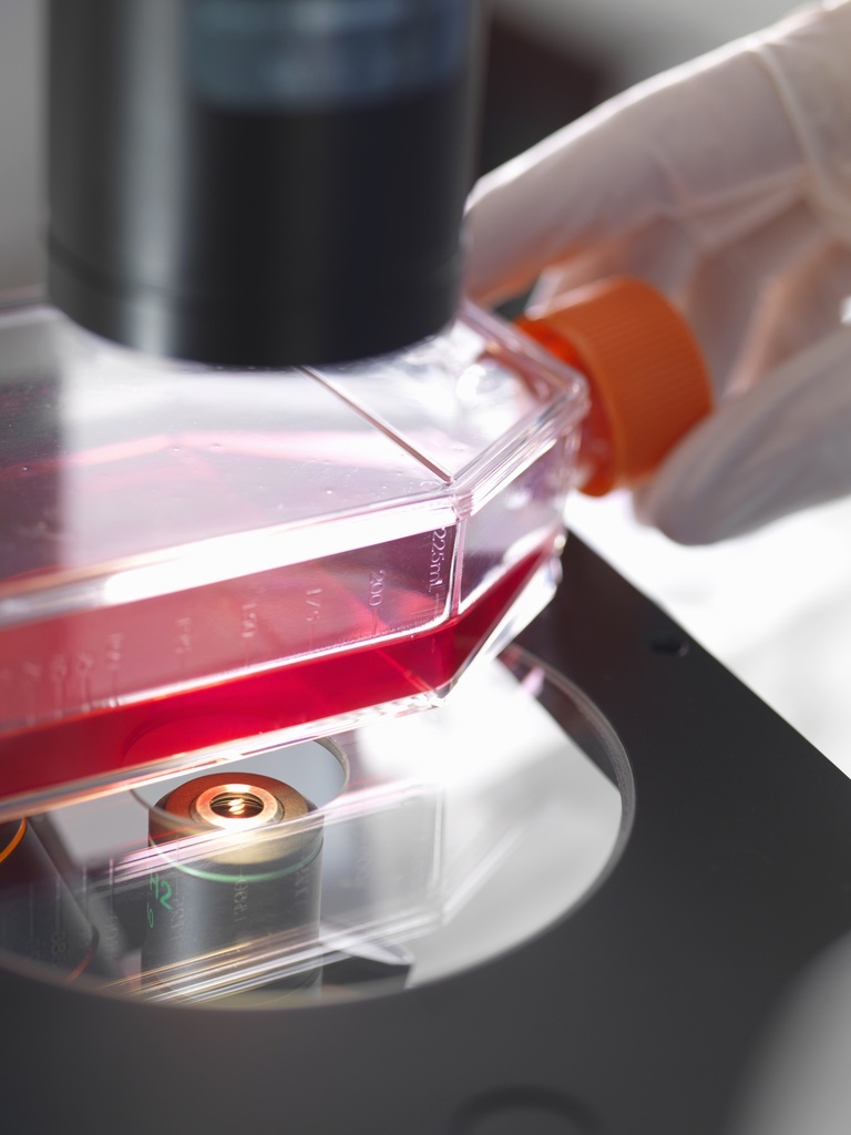 Mouse Parathyroid Cells | GlycoTech Corporation